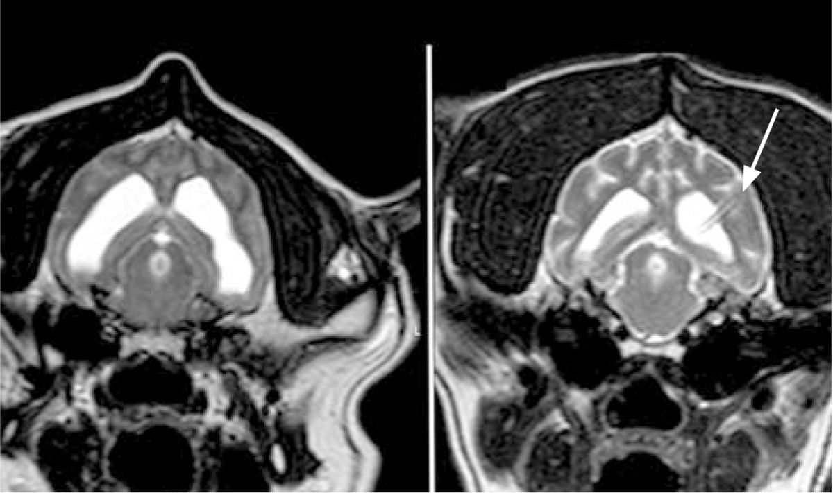 Canine Hydrocephalus Mri