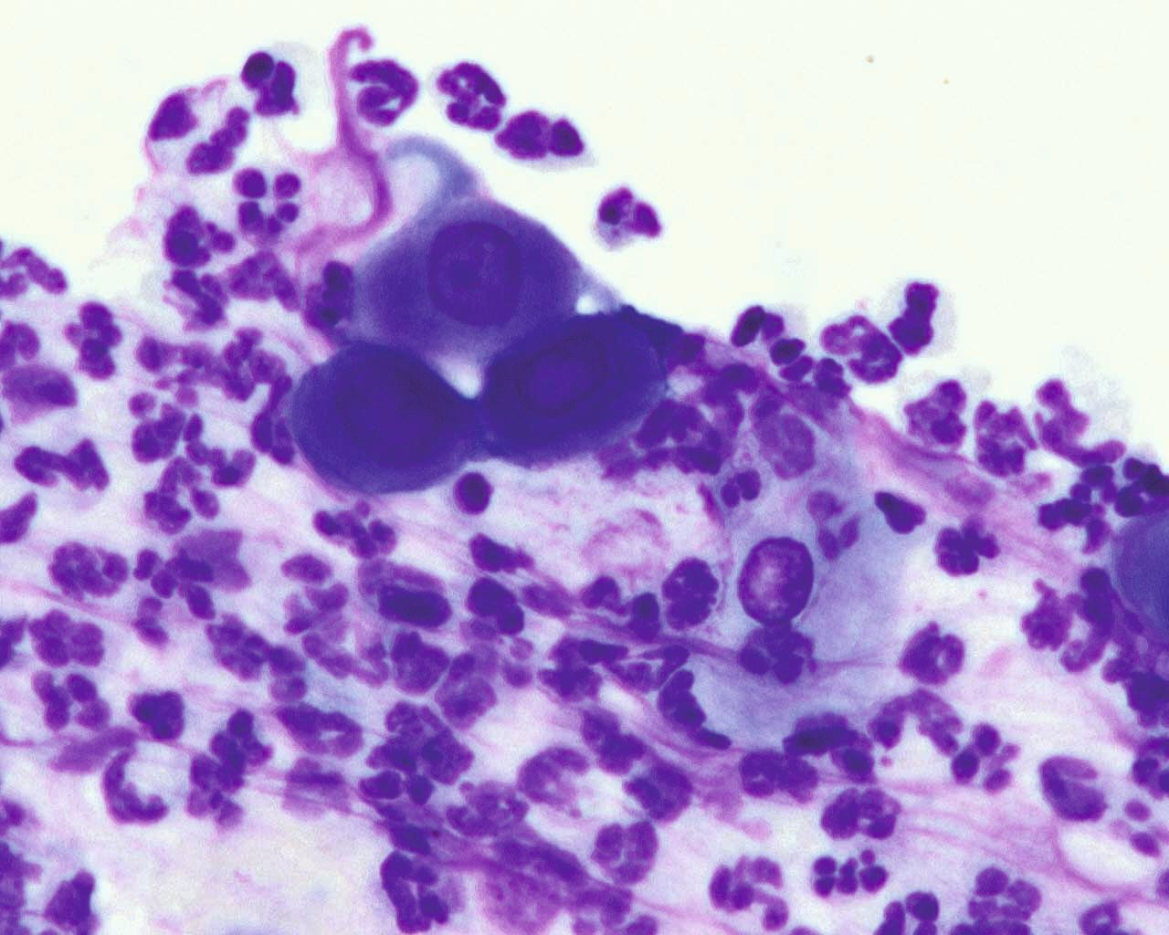 Causes and Treatment of Feline Pododermatitis | Vet Focus